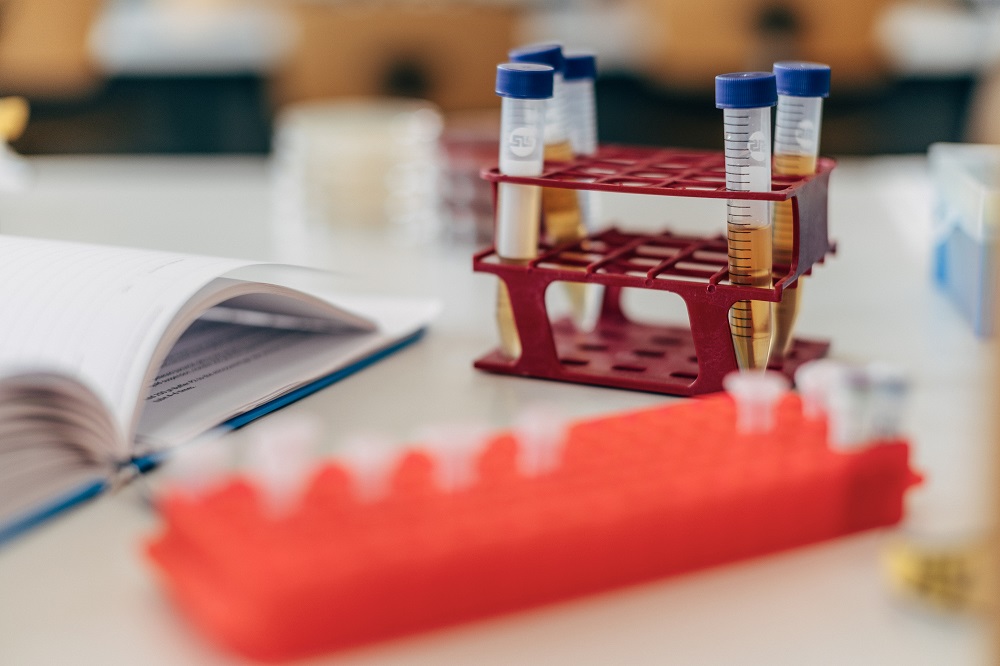 Biomedical Science Degree BSc (Hons) UON